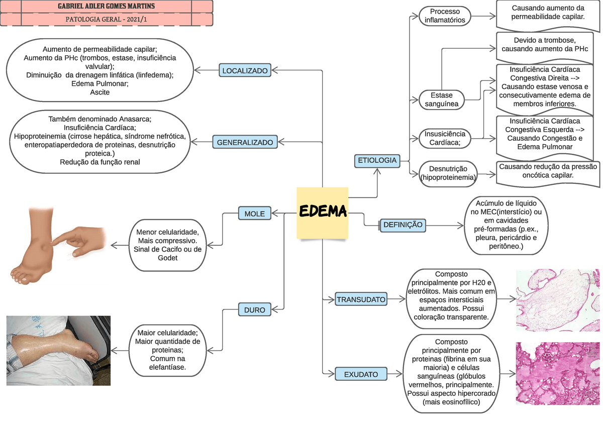 Mapas Mentais sobre EDEMA - Study Maps